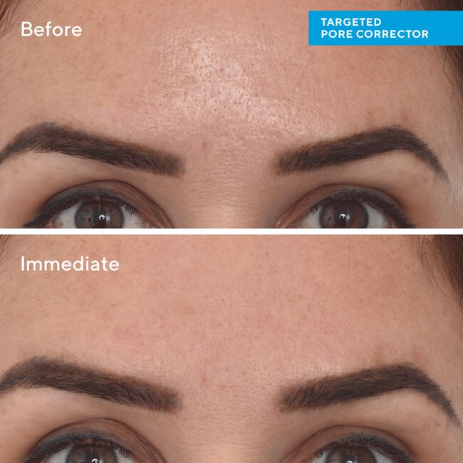 Targeted Pore Corrector - Murad | CosmoProf