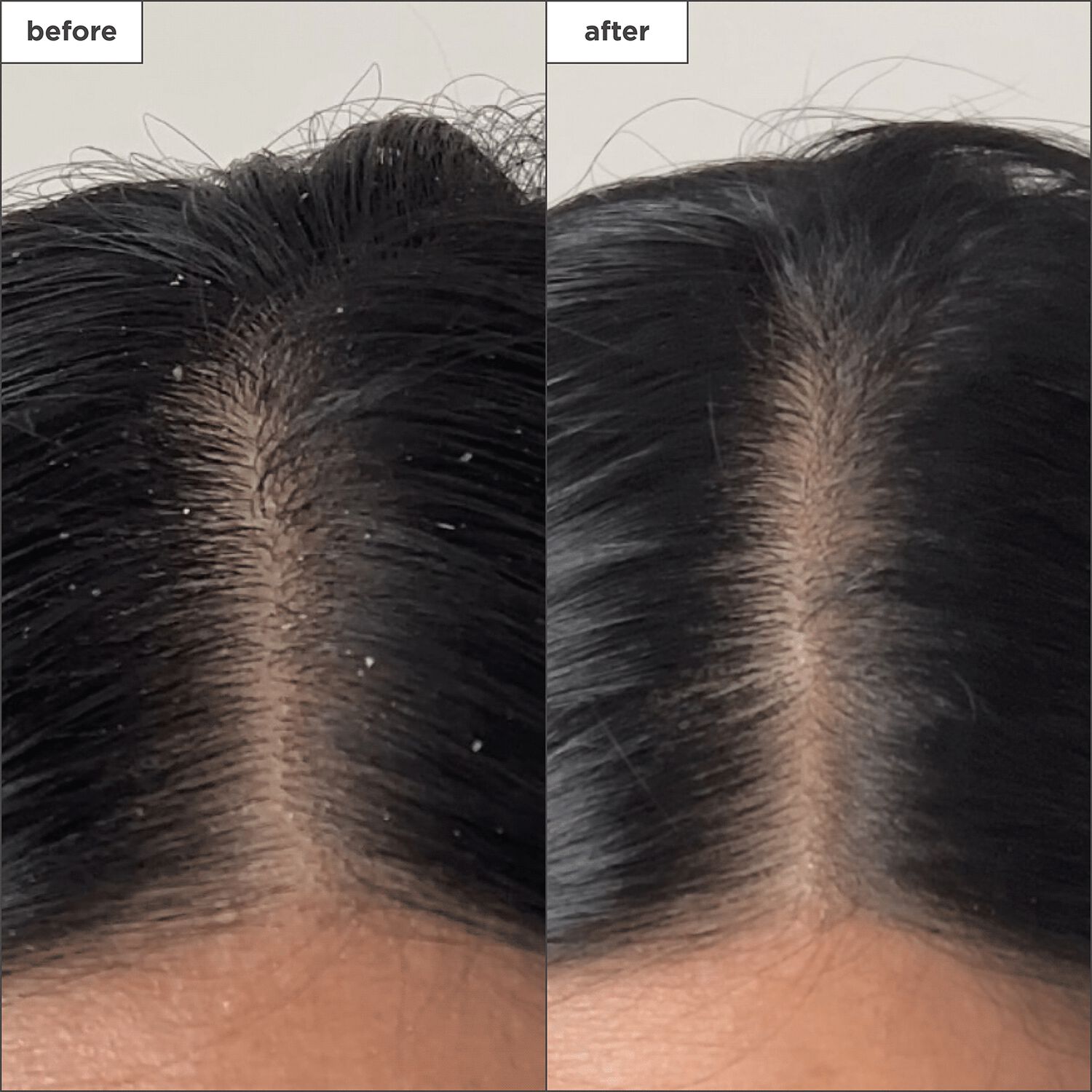 Scalp Revival Charcoal & Tea Tree Buildup Detox Spray - Briogeo | CosmoProf