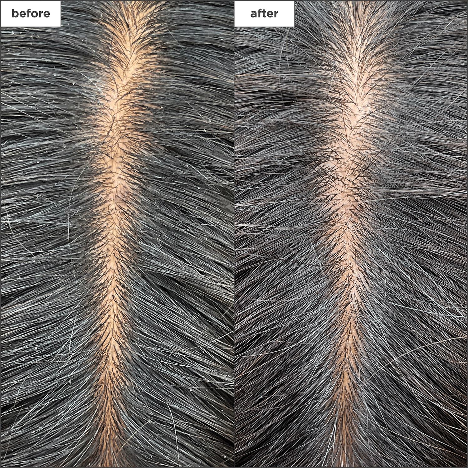 Scalp Revival Charcoal & Tea Tree Cooling Hydration Scalp Mask ...