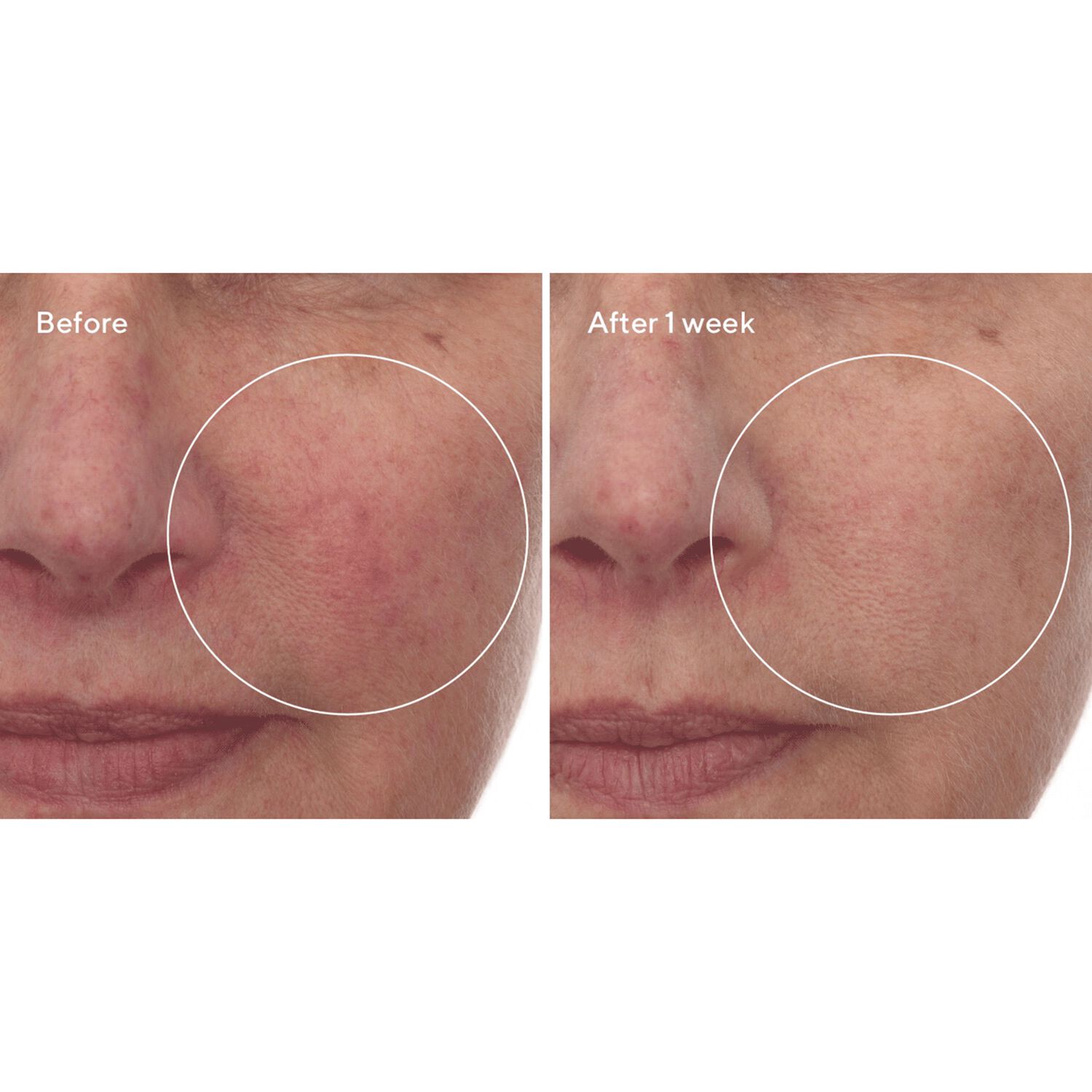 Cellular Hydration Repair Serum - Murad | CosmoProf