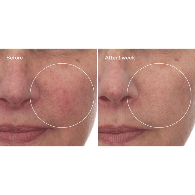 Cellular Hydration Repair Serum - Murad | CosmoProf