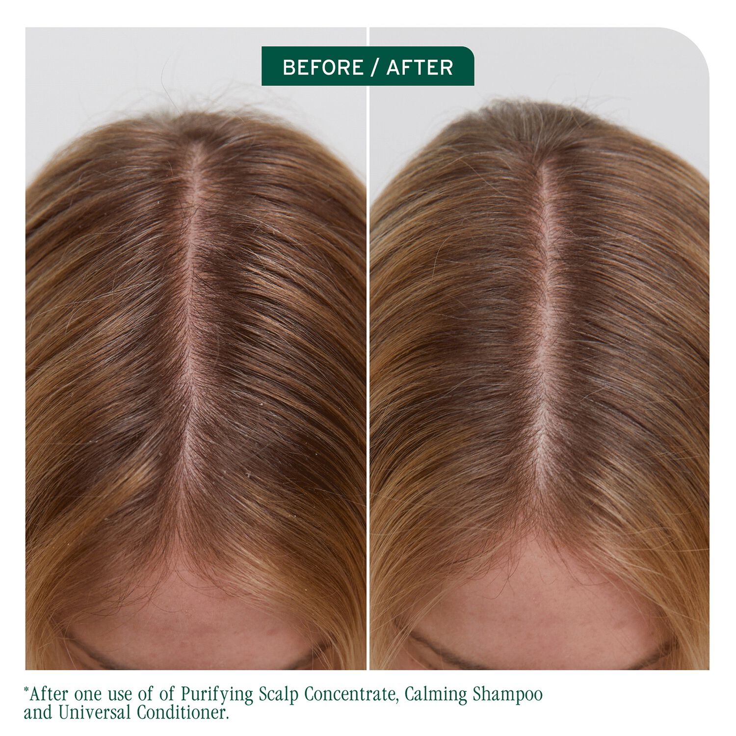 Scalp Sync Calming Shampoo for Dry Sensitive Scalp - Biolage | CosmoProf