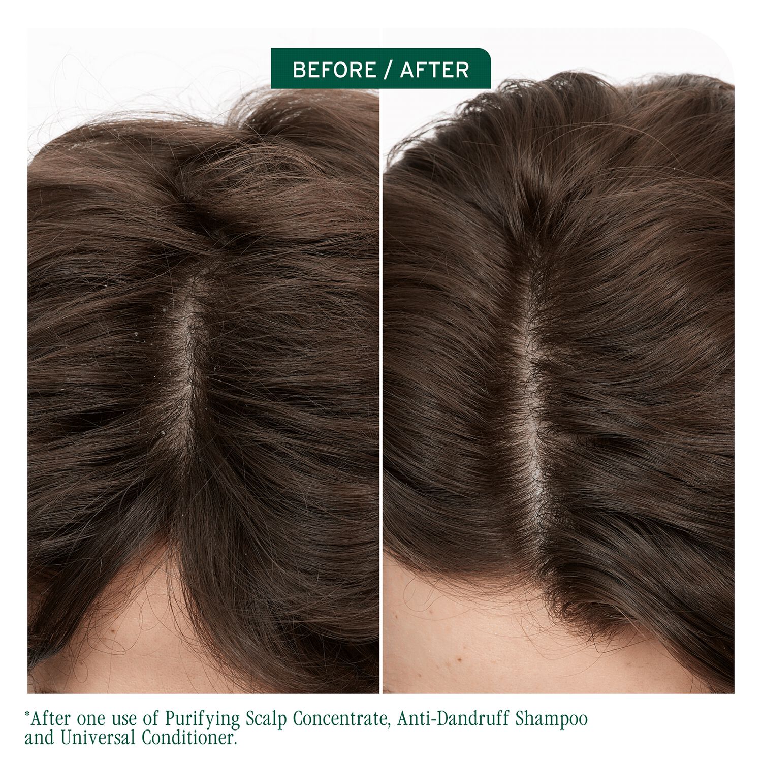 Scalp Sync Pyrithione Zinc Antidandruff Shampoo - Biolage | CosmoProf