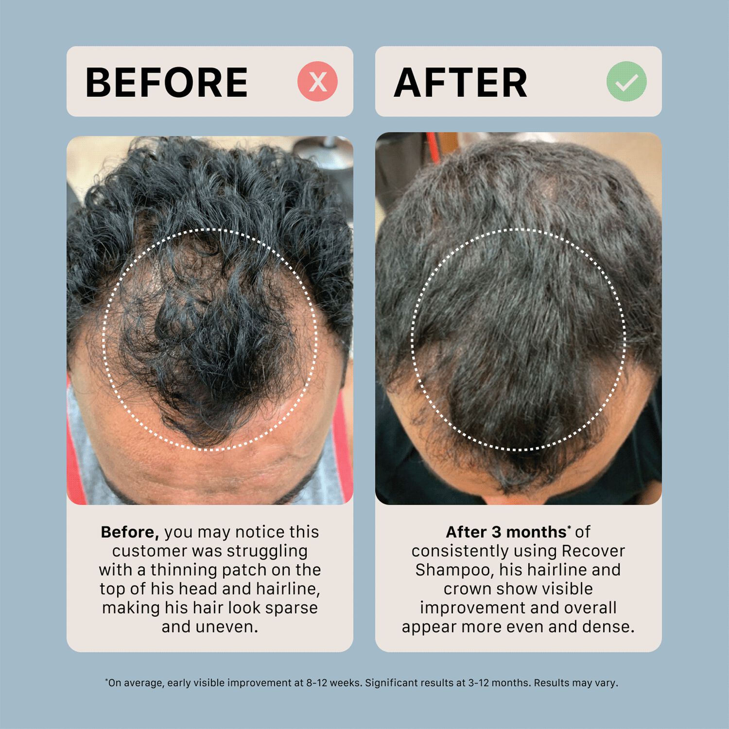 Recover Shampoo & Conditioning System for Men - ACTiiV Hair Science ...