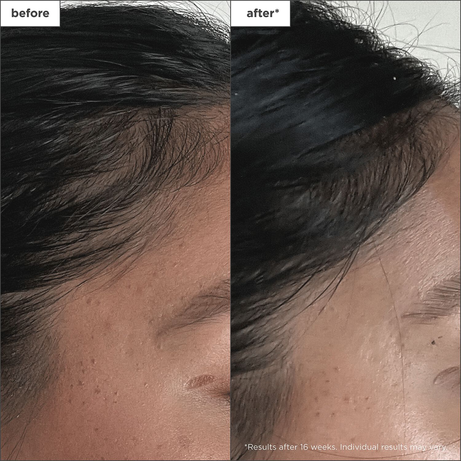 Destined for Density MegaStrength+ Caffeine & Biotin Peptide Density ...